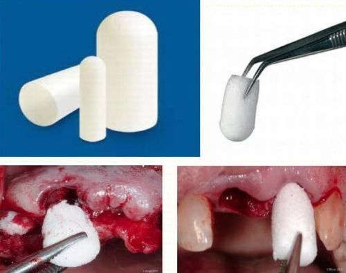 COLO PLUG RESORBABLE COLLAGEN PLUG (PURE COLLAGEN SPONGE) 8 x 20mm - 1 ...