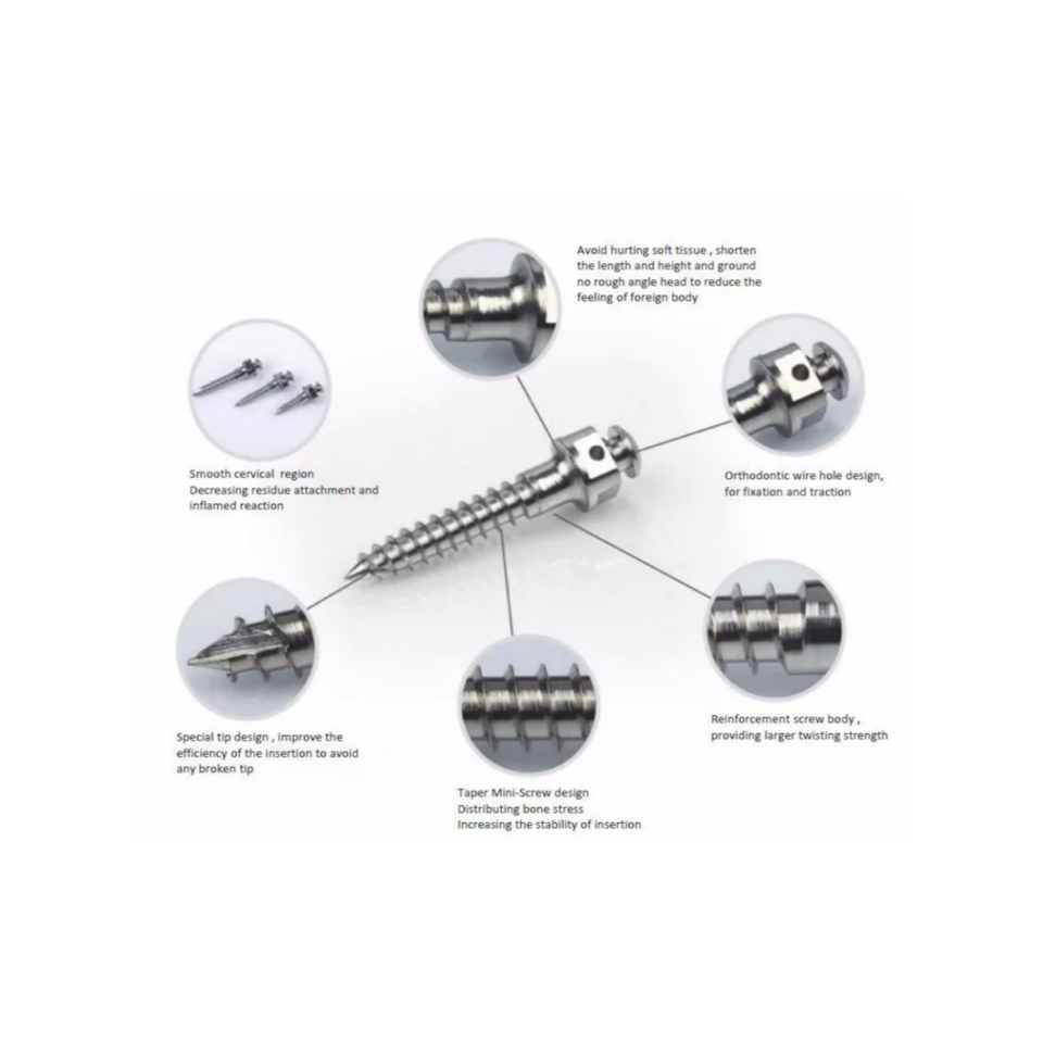 Dental Orthodontic Mini Screw Implants Bone Anchor Micro Screws Screwdriver | eBay