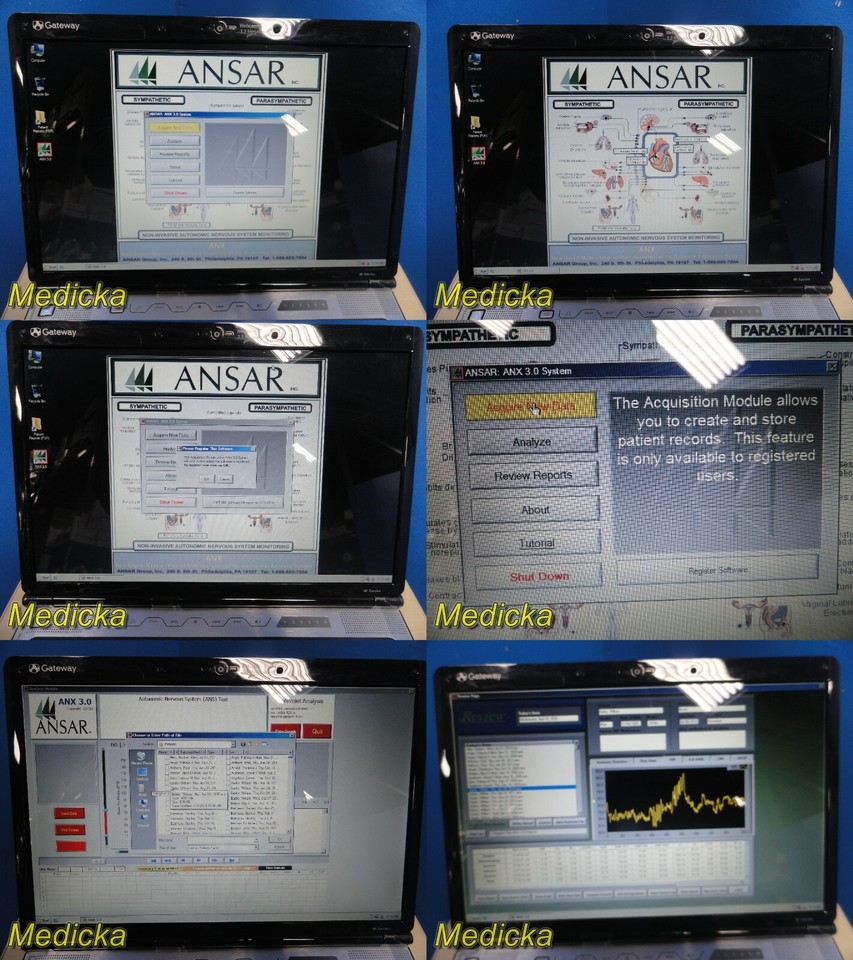 ANSAR ANX 3.0 Autonomic Nervous System Monitor W/ Cart & Printer ...