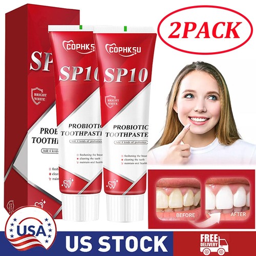 2pack Sp 10 Pasta Dental Whitening Sp10 Probiotic Toothpaste 100g | eBay