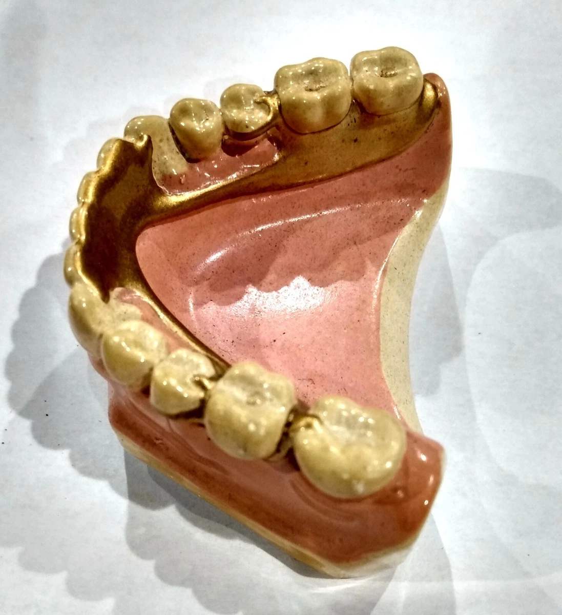 Dentures With Gold On Them