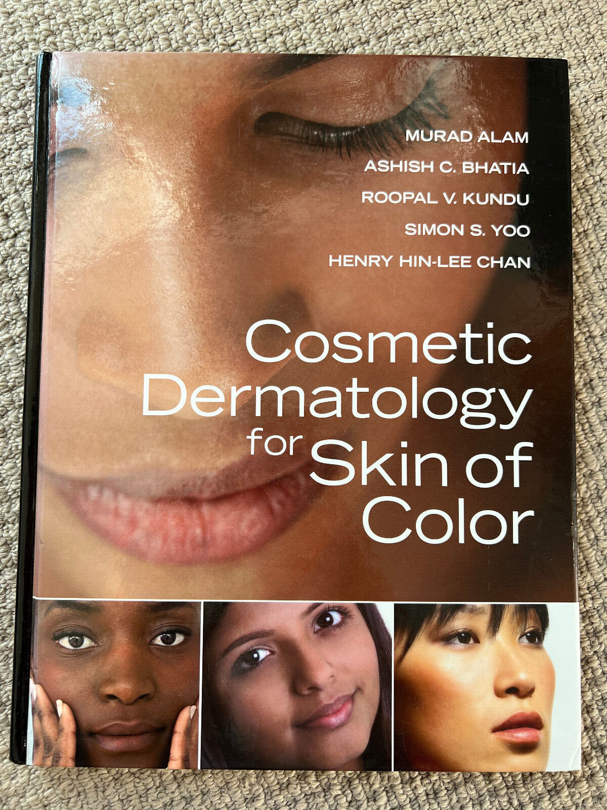 Cosmetic+Dermatology+for+Skin+of+Color+by+Ashish+Bhatia%2C+Roopal+Kundu ...