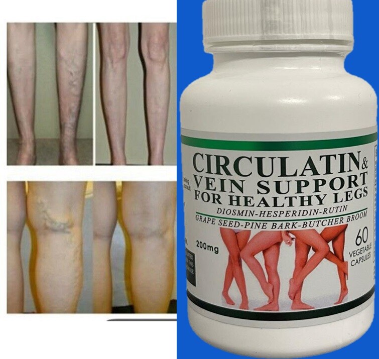 Natural Pills For Blood Circulation Legs Arm Veins, Circulación ...