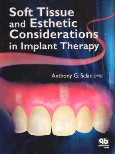 Soft Tissue and Esthetic Considerations in Implant Dentistry by Anthony ...