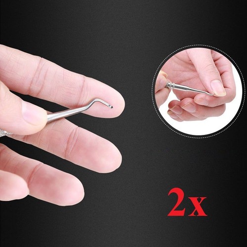 2x Ingrown Toe Nail Fixer Pedicure Toenail Recover Correction Lifter ...