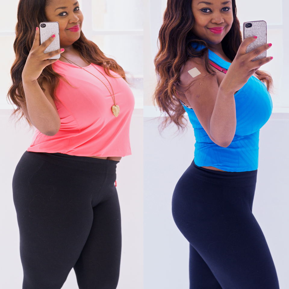 LipoPatch Fat Burning Lipotropic Injection Patches 30 Day Supply | eBay