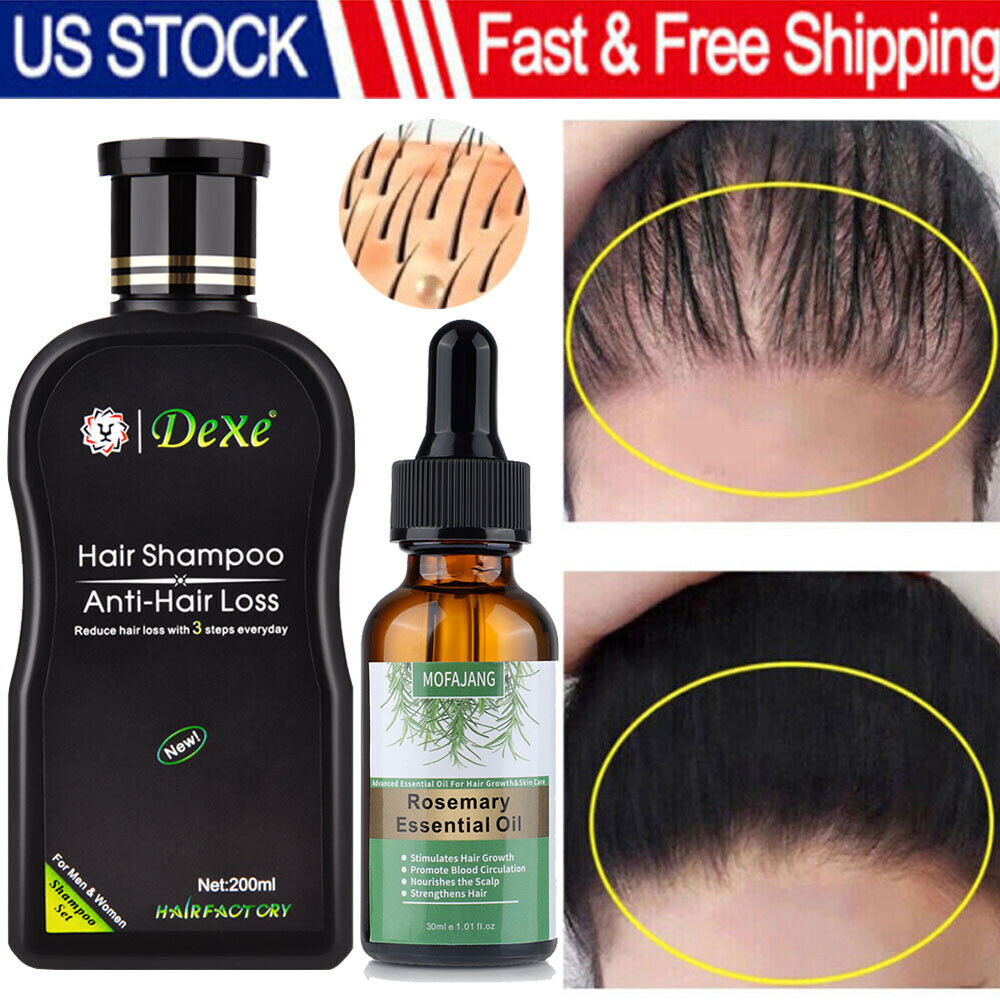 Dexe Hair Growth Shampoo Natural Herbal Anti Hair Loss Treatment Serum ...