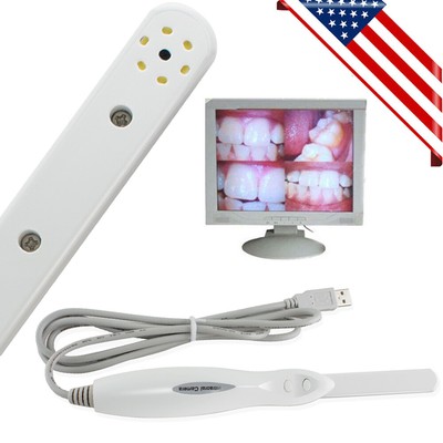 Dental Imaging & X-Ray - Dexis Intraoral Camera