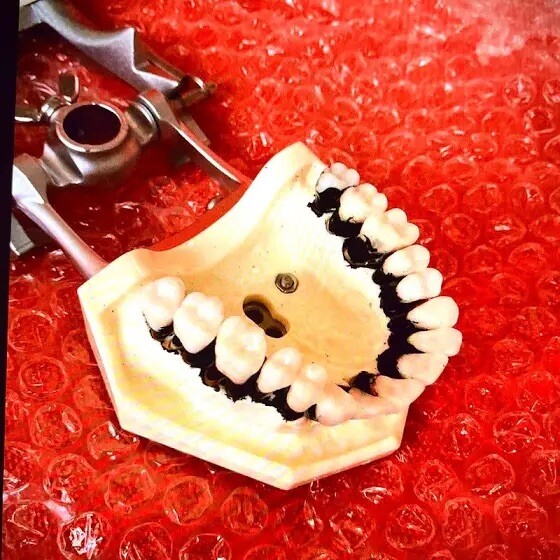 Dental Perio Typodont 32 Teeth JAPAN Nissin TR56D ADEX WREB Board ...