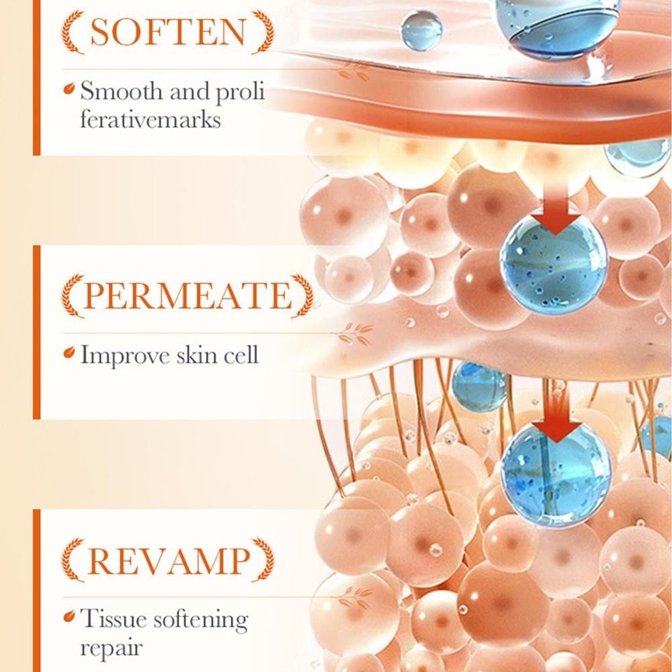 40g Scar Removal Cream for Old-Scars Stretch Mark Removal Cream Rapid ...