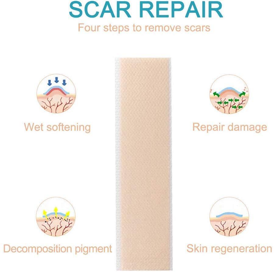 Aliver Silicone Soft Adhesive Fabric Strips C-Sections Scar Removal ...