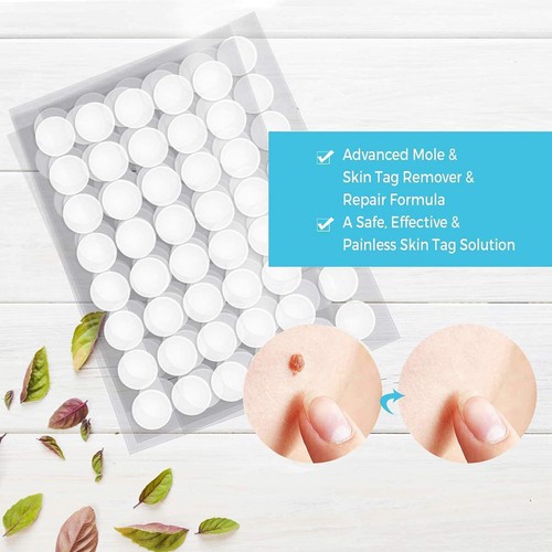 40Pcs/Set Skin Tag Remover Gentle Quick Effect Skin Tag Acne Plaster ...
