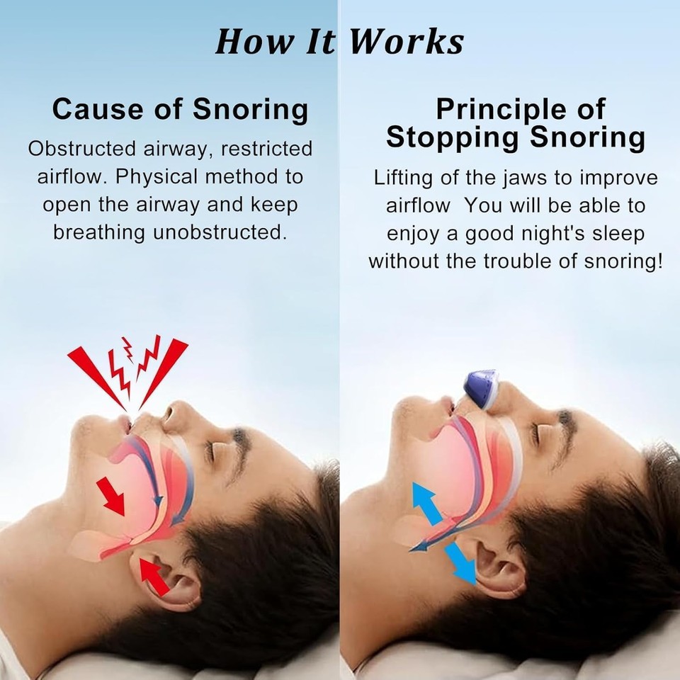 Micro Electric Mini Anti Snoring Device Electric Sleep Apnea Relief ...