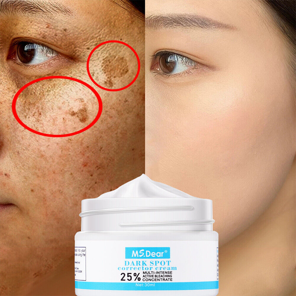 Fading Dark Spots On Face