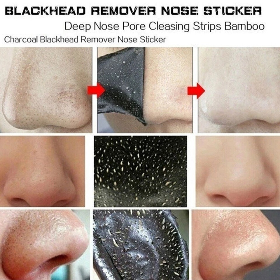 1-100pcs Nose Pore Strips Blackhead Removal Unclog Pores Smooth Deep ...