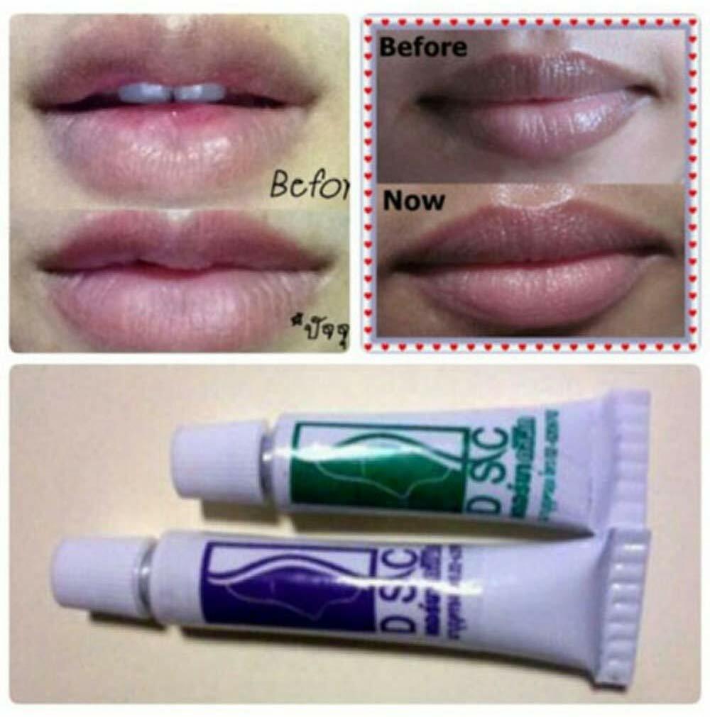 Black Smoke Lips @YUNdonasf96a # Remove Dark Smoke Lips # Pink Fresh