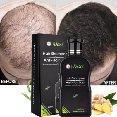 200ml Dexe Fast Hair Growth Shampoo Anti Hair Loss Hair Thickening For ...