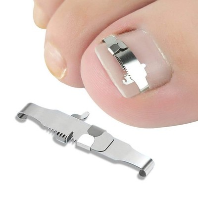 Ingrown Toenail Straightening Clip Stainless Steel Toenail Correction ...