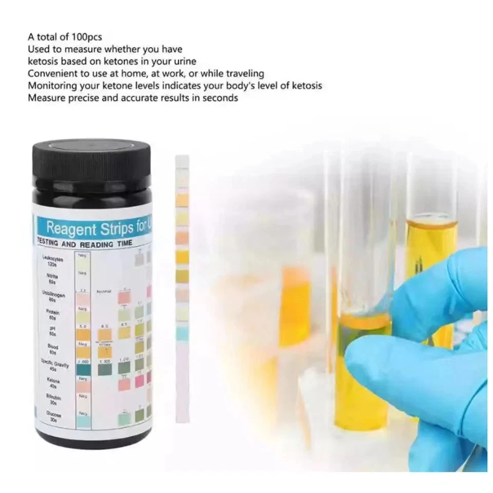 100 Strips Urine Test Strip 10 Parameters Urinalysis Dip-Stick PH Test ...
