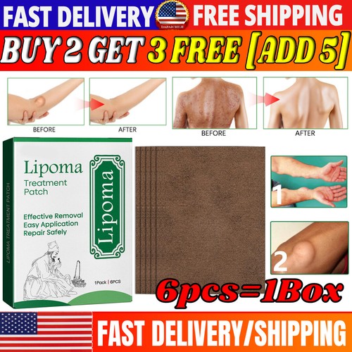 Lipoma Removal Cream Body Treatment Patch Anti-Swelling Pain Relief ...