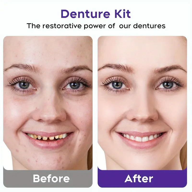 DIY Full Denture Set Upper & Lower Teeth w/Pink Gum Base for Missing ...