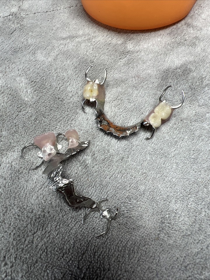Metal Partial Dentures, Dental Teeth, Vintage Dentist White Metal Scrap ...