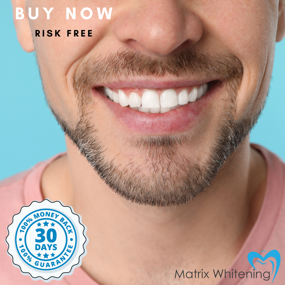 TEETH WHITENING KIT DENTIST STRENGTH WHITE SMILE MATRIX SUPER LED ...