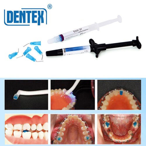 Dental Orthodontic Adhesive Light Cure Band Cement Blue Glue Intro Kit ...