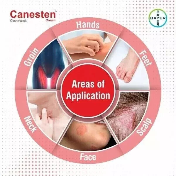 Canesten Anti-Fungal Cream (30g X 3) For Itching, Ring Shaped Rash ...