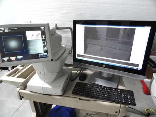 Topcon TRC-NW400 Non-Mydriatic Digital Retina Camera w/ Computer and ...