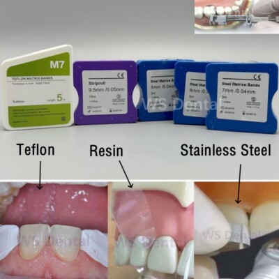 Dental Teflon/Resin/Metal Matrix Bands Teeth Restoration Matrix Strips ...
