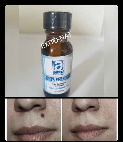 QUITA VERRUGA SKIN TAG REMOVER SANI SKIN WART REMOVER HOMEPATHIC ...