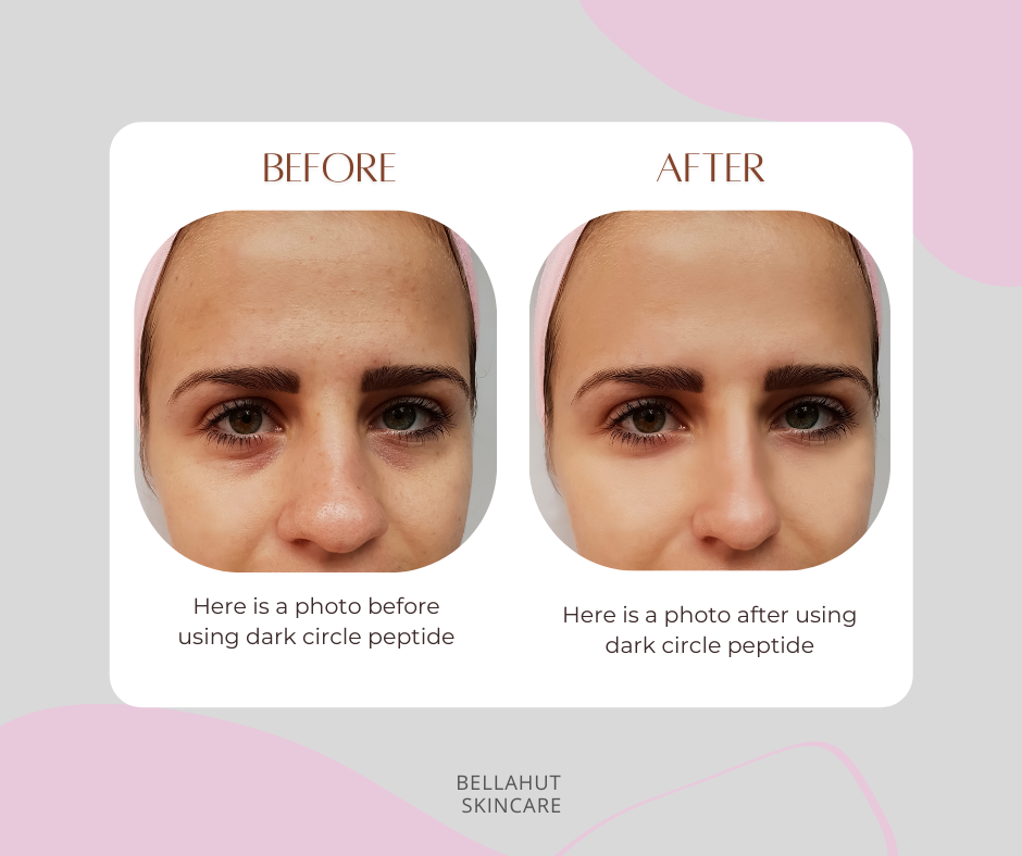 H a l o x y l EYE DARK CIRCLES PIGMENTATION REVERSE PEPTIDE | eBay