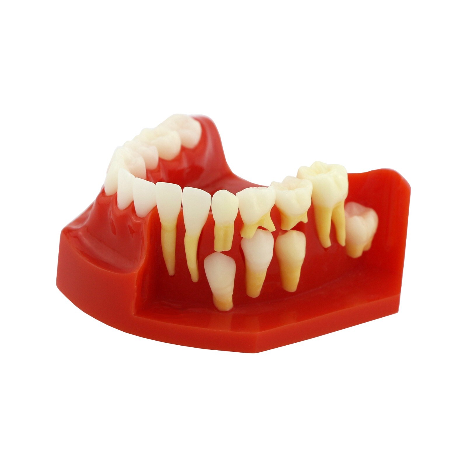 Dental Children Pathology Typodont Teeth Model Tooth Eruption ...