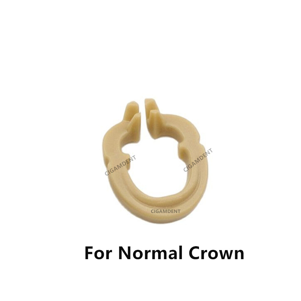 Dental Matrix Bands Fit Triodent Palodent V3 Sectional Contoured ...