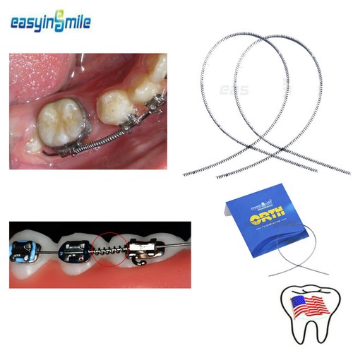 Dental Open Coil Spring NITI Alloy Ortho 180mm For Teeth Brackets ...