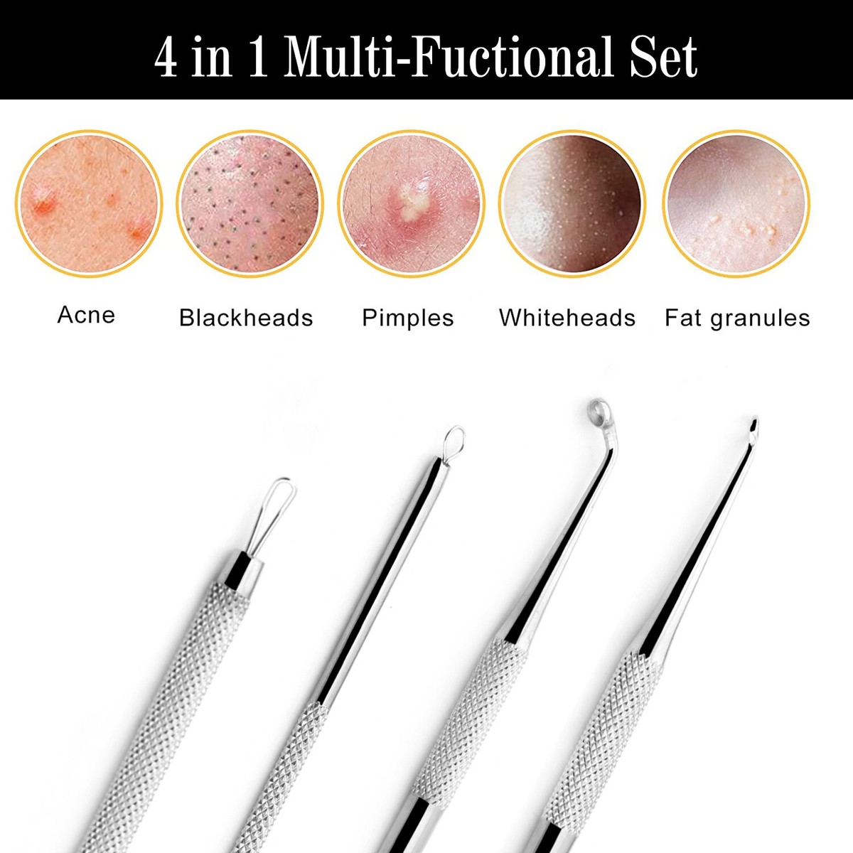 Whitehead Removal 2022 Newest Blackhead Remover Tools 2 PCS Acne
