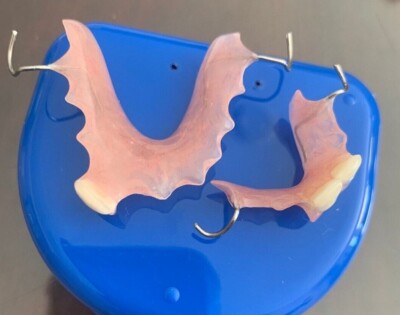 CUSTOM MISSING TEETH FLIPPER/ StayPlate for Upper Lower (Hard Acrylic ...