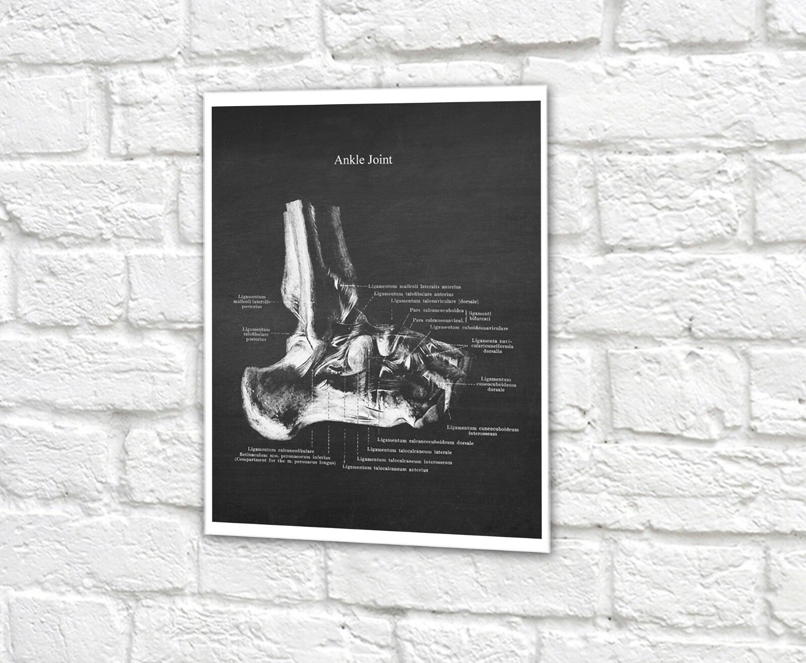 Anatomy Decor Poster set of 3 Unframed Posters Hip Knee Ankle Joints ...