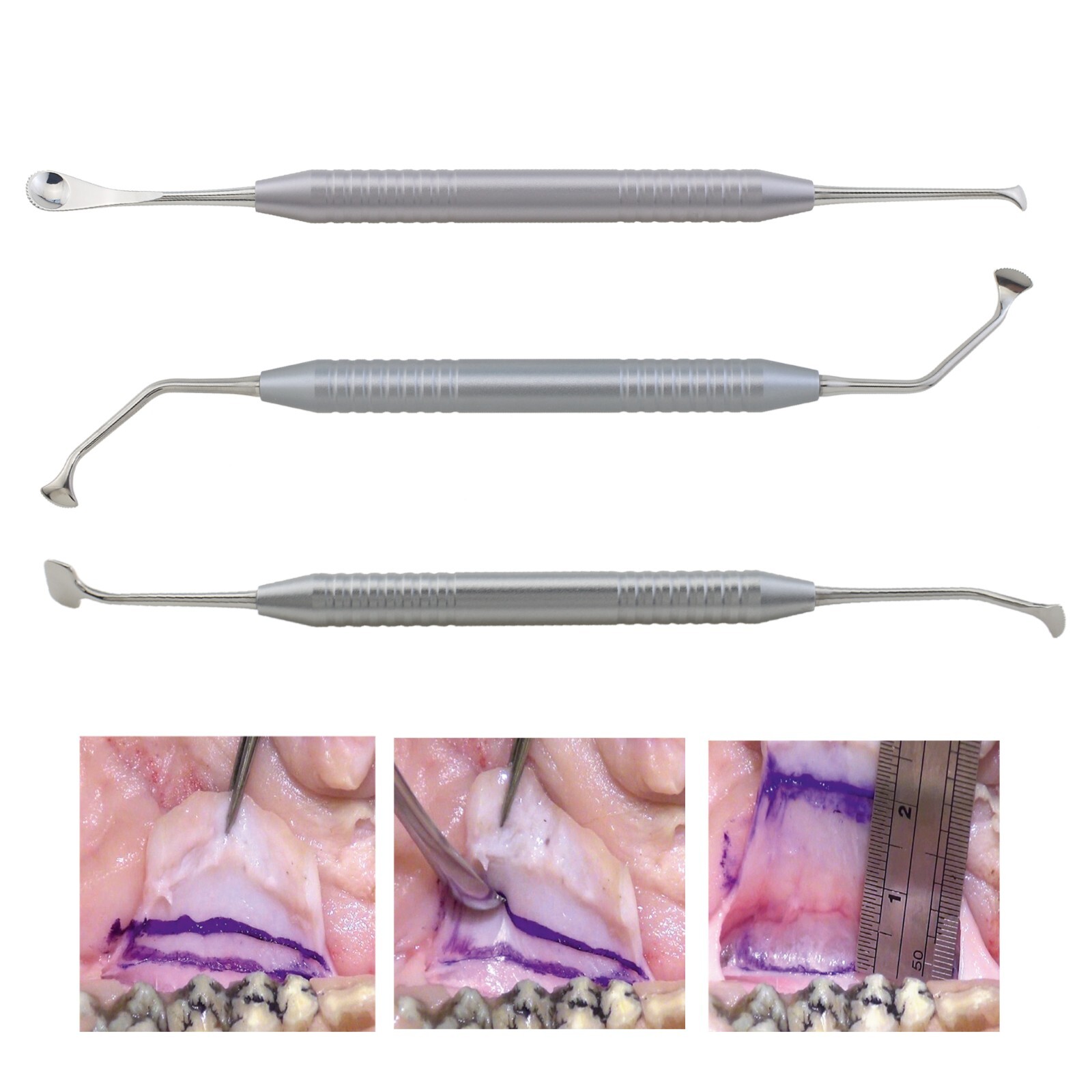 WEN Tension Release Comb Set W-TRC Dental Implant Instruments HELMUT ...