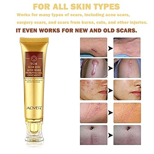 Crema Para Eliminar Cicatrices Borrar Quemaduras Heridas Cirugias ...