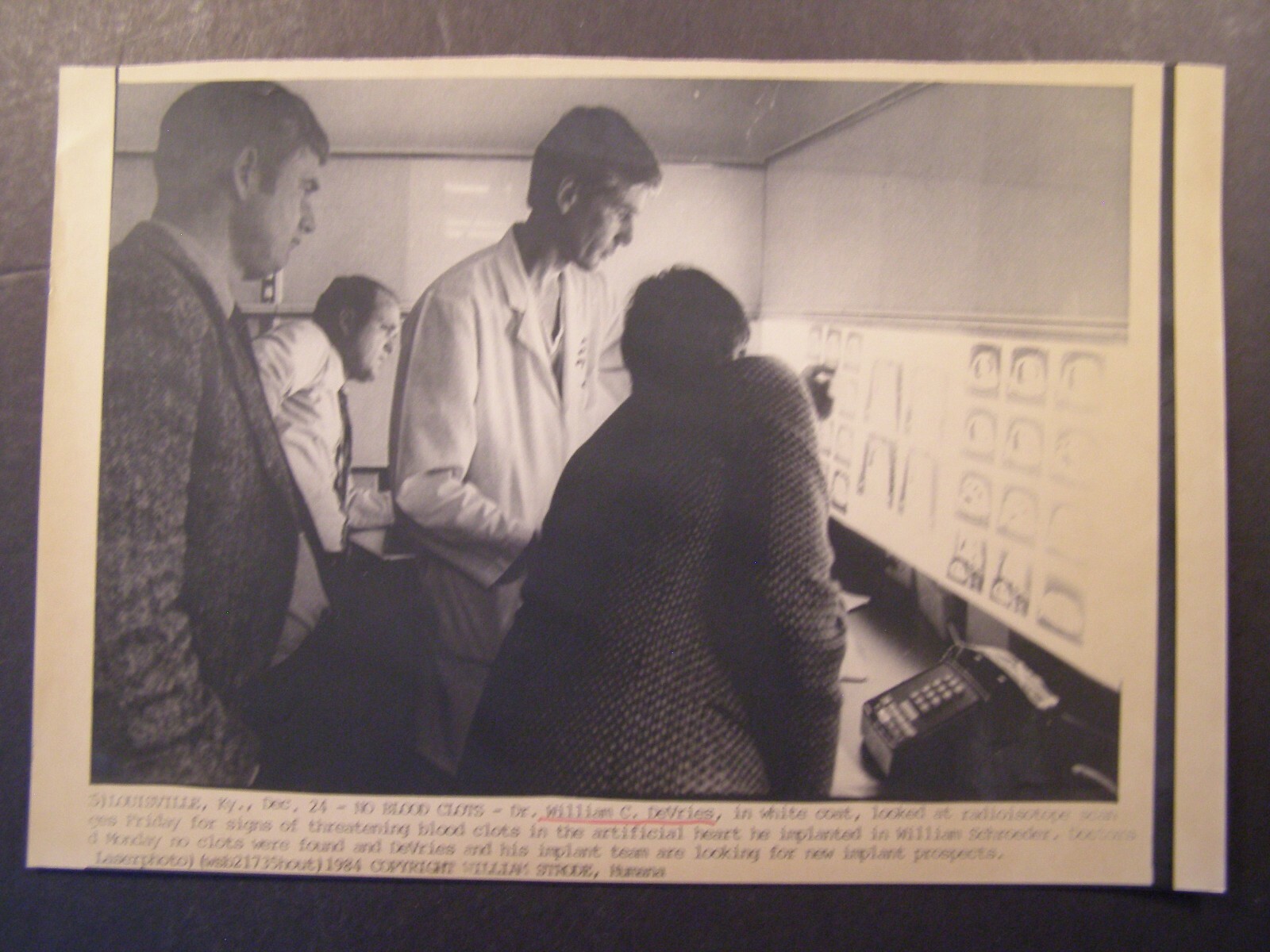 AP Wire Press Photo 1984 Dr William DeVries looks at William Schroeder ...