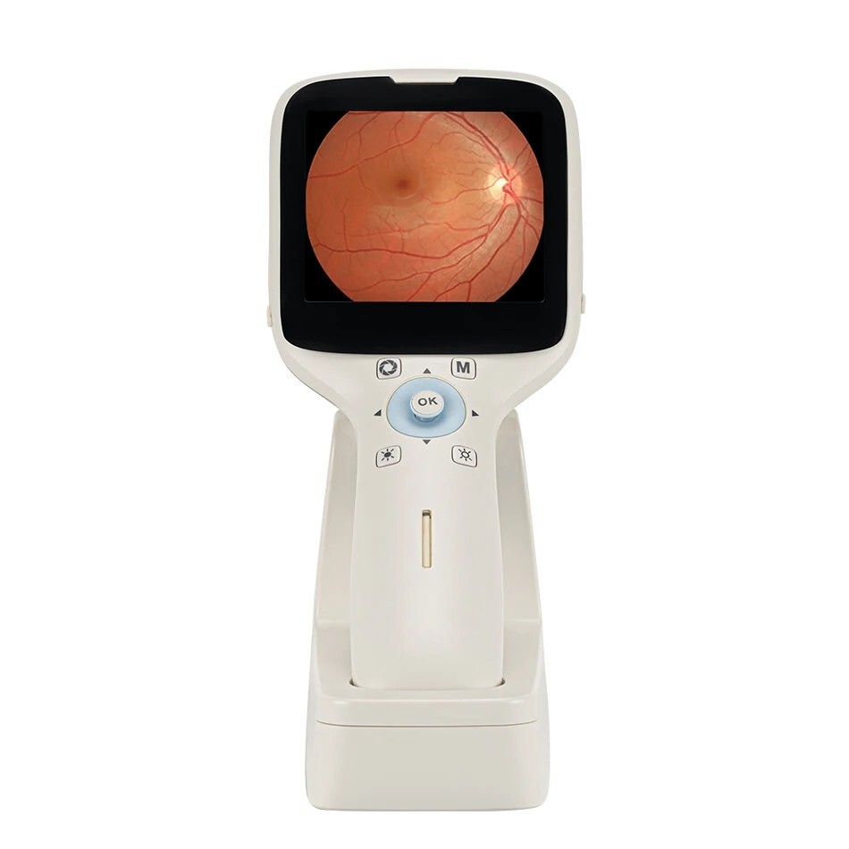 Ophthalmic instruments Portable hand-held fundus camera Optical ...