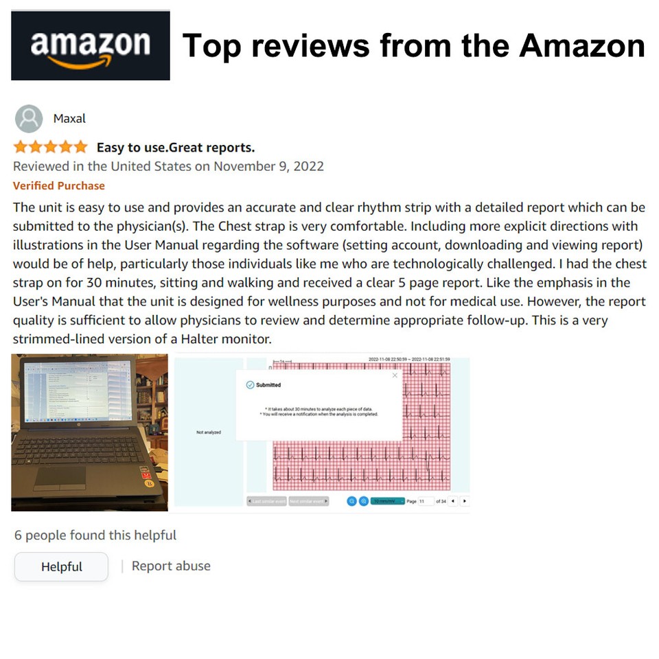 24h Holter Monitor ECG Recording Detailed Reports by AI Analysis US ...