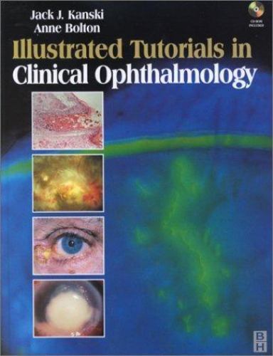 Illustrated Tutorials in Clinical Ophthalmology by Jack J. Kanski and ...