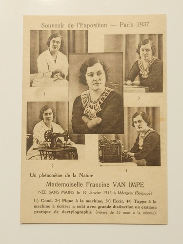 1937 Souvenir de l'Exposition PARIS FRANCINE VAN IMPE Born Without Hand ...