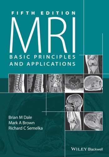 MRI : Basic Principles and Applications by Richard C. Semelka, Mark A ...