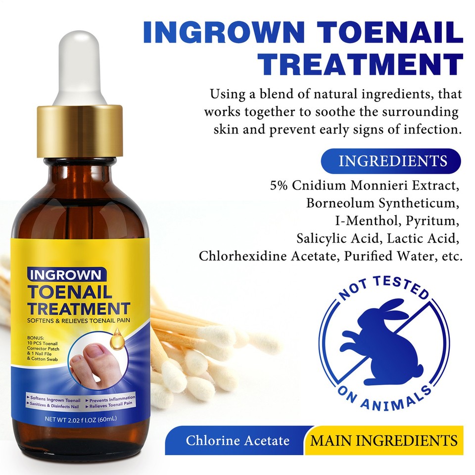 Ingrown Toenail Kit Ingrown Toenail Relief Treatment Drops Corrector ...