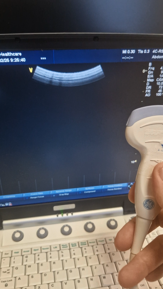 GE Vivid e R5 Portable Diagnostic Ultrasound System | eBay