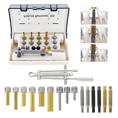 Dental Implant Fixture Removal Kit Neobiotech FR Fixture Remover Screw ...